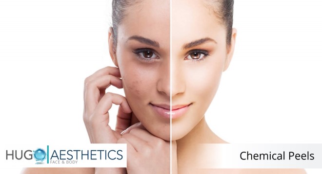 Chemical Peels: Hugo Aesthetics